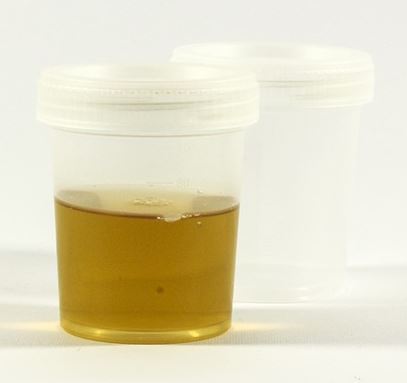 How to Preserve Human Urine: 9 Simple Tips For Storing It